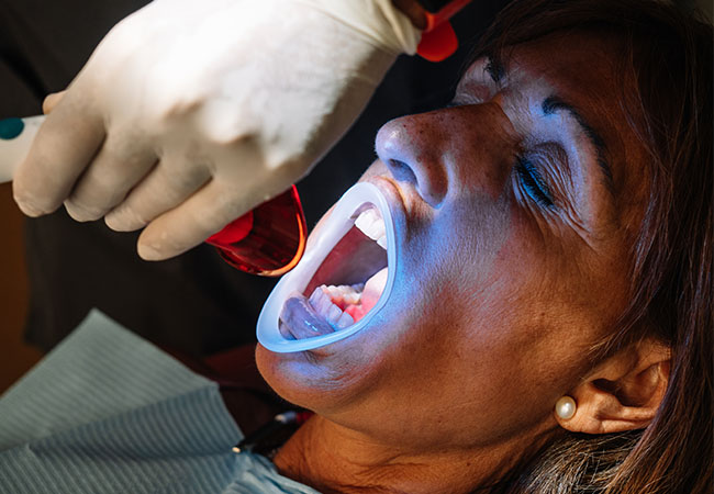 What Are the Chances of Surviving Oral Cancer with Early Detection?